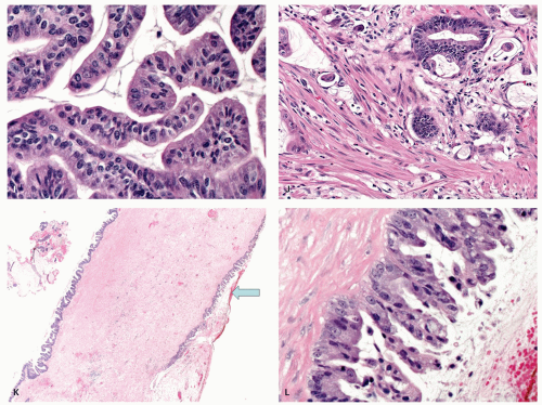 C15-FF51.gif | Abdominal Key