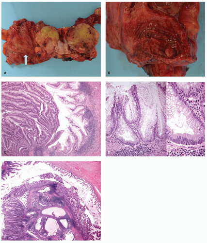 C15-FF53.gif | Abdominal Key