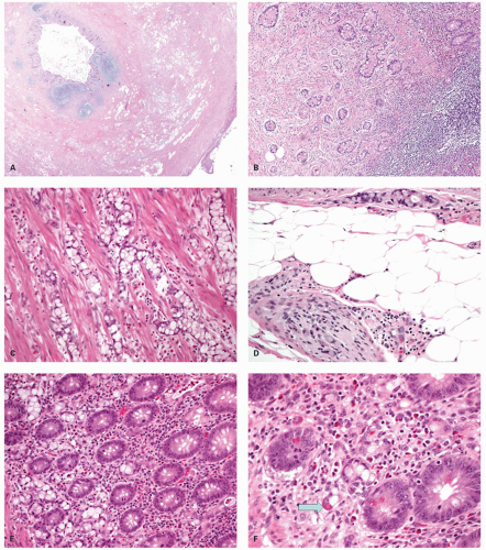 C15-FF56.gif | Abdominal Key