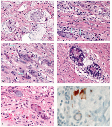 C15-FF60.gif | Abdominal Key