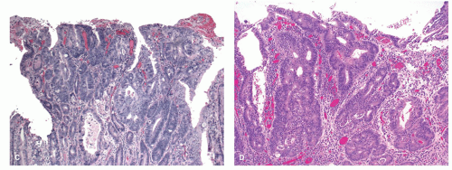 C18-FF100.gif | Abdominal Key