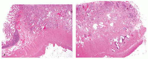 C18-FF111.gif | Abdominal Key