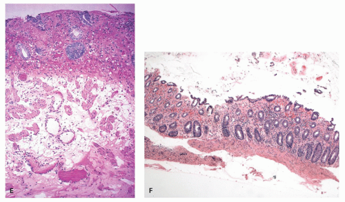 C18-FF138.gif | Abdominal Key
