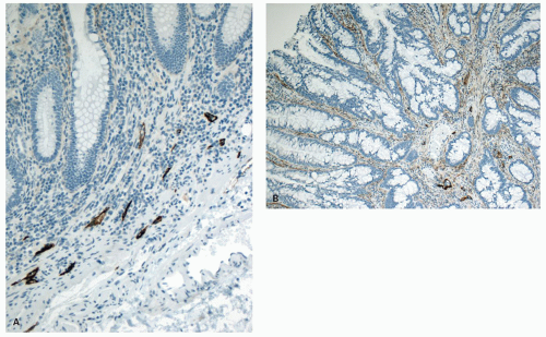 C20-FF100.gif | Abdominal Key