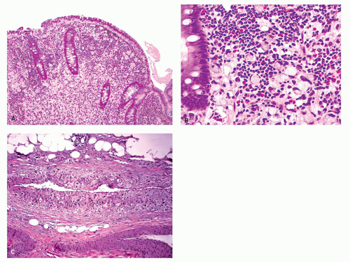 C20-FF111.gif | Abdominal Key