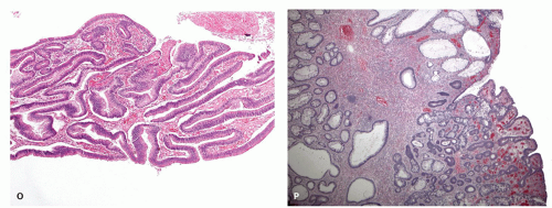C20-FF77.gif | Abdominal Key
