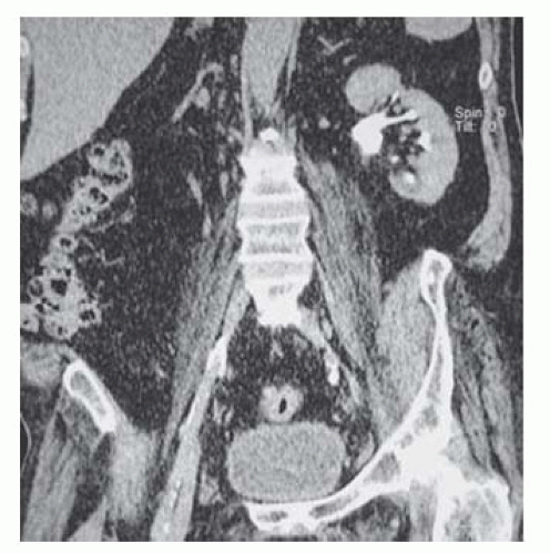 C3-FF12.gif | Abdominal Key