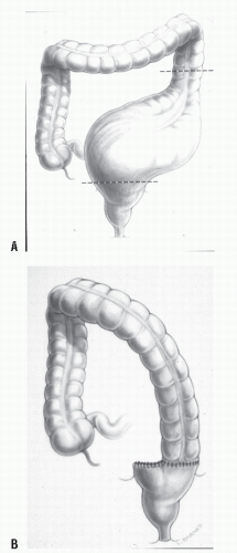 C3-FF46.gif | Abdominal Key