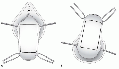 C31-FF1.gif | Abdominal Key