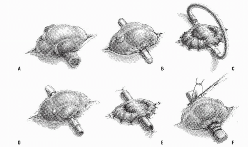 C31-FF28.gif | Abdominal Key