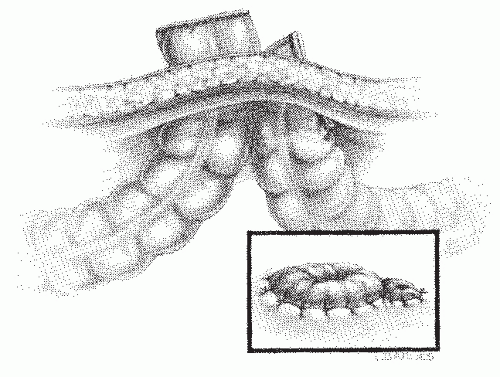 C31-FF38.gif | Abdominal Key
