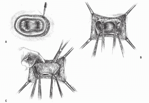 C31-FF43.gif | Abdominal Key