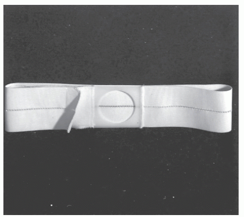 C31-FF68.gif | Abdominal Key