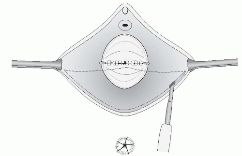 C31-FF9.gif | Abdominal Key