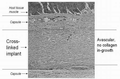 C32-FF3.gif | Abdominal Key