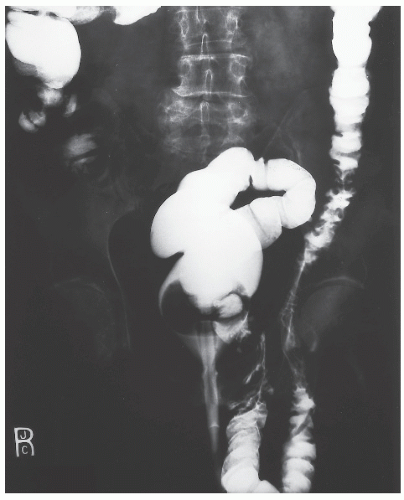 C5-FF15.gif | Abdominal Key