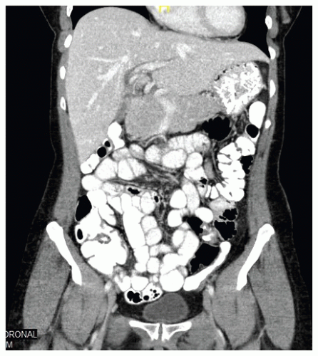 C5-FF29.gif | Abdominal Key