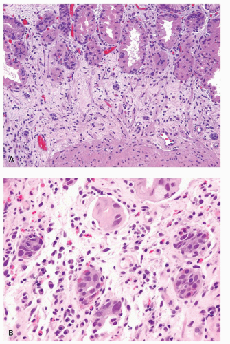 C5-FF30.gif | Abdominal Key