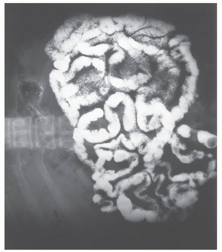 C5-FF33.gif | Abdominal Key