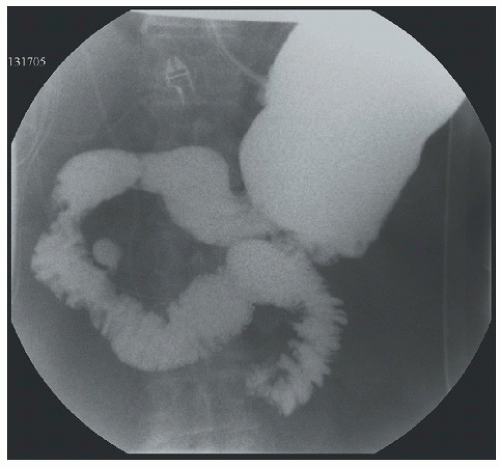 C5-FF34.gif | Abdominal Key