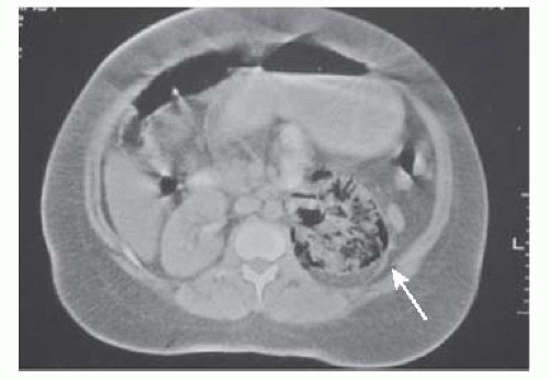 C6-FF1.gif | Abdominal Key