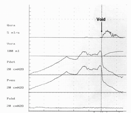 C6-FF3.gif | Abdominal Key