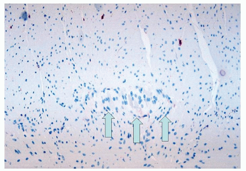 C6-FF36.gif | Abdominal Key
