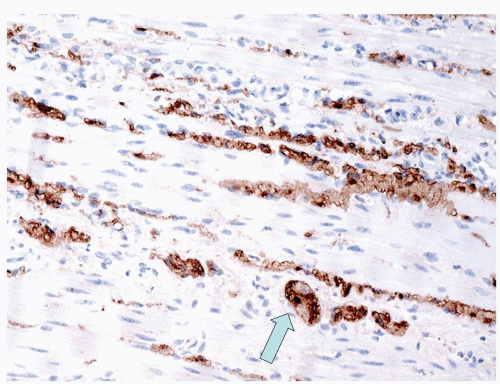 C6-FF37.gif | Abdominal Key