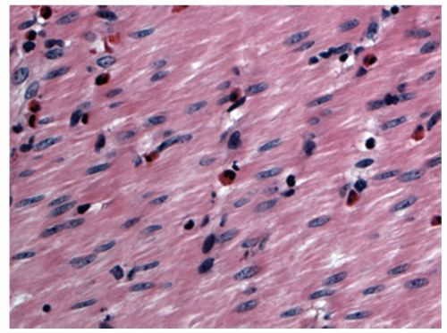 C6-FF51.gif | Abdominal Key