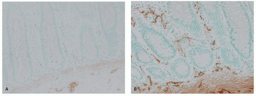 C6-FF57.gif | Abdominal Key