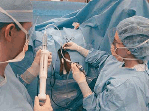 DA3C13FF10.gif | Abdominal Key