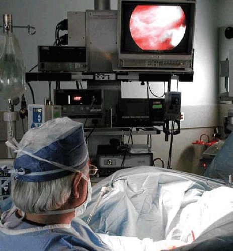 DA4C20FF6.gif | Abdominal Key