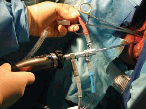 DA4C20FF9.gif | Abdominal Key