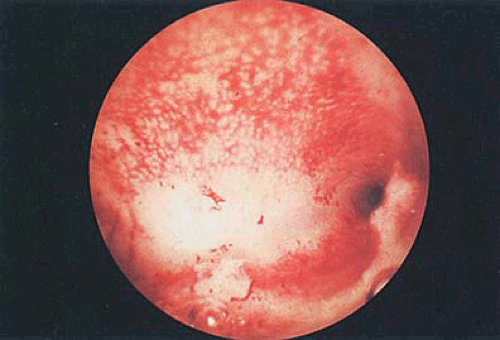 DA5C28FF29.gif | Abdominal Key