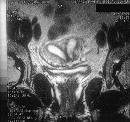 DA5C28FF37.gif | Abdominal Key