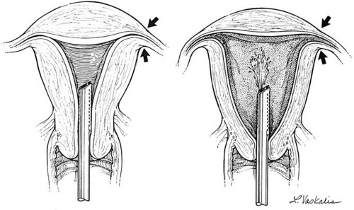 DA6C30FF18.gif | Abdominal Key