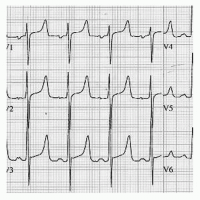 DA9-Review_Questions-MMU5.gif | Abdominal Key