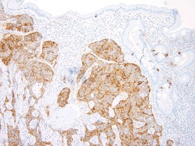 image01219.jpeg | Abdominal Key