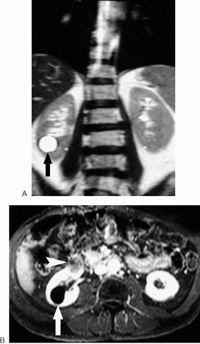 C3-2-FF67.gif | Abdominal Key
