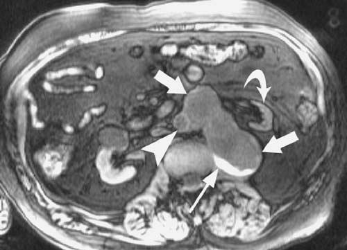C3-3-FF66.gif | Abdominal Key