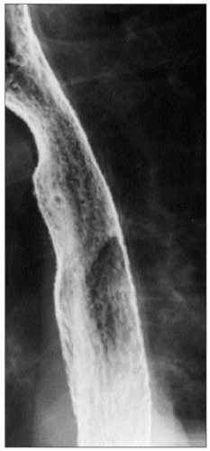 C4-FF94.gif | Abdominal Key