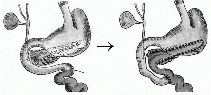 C7-09-MMU5.gif | Abdominal Key