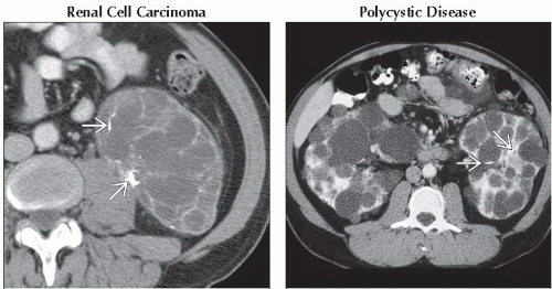 DA1-DB1-Abdominal_Calcifications-FFU12.gif | Abdominal Key