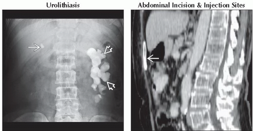 DA1-DB1-Abdominal_Calcifications-FFU3.gif | Abdominal Key