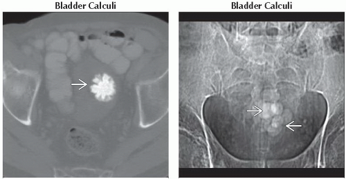 DA1-DB1-Abdominal_Calcifications-FFU9.gif | Abdominal Key