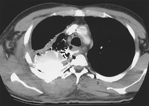 DA1C9FF19.gif | Abdominal Key