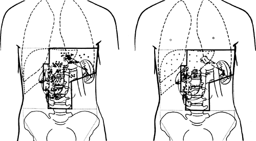 DA3C23FF2.gif | Abdominal Key