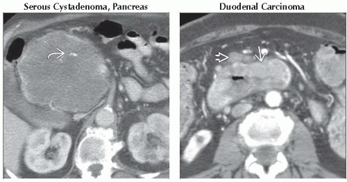 DA4-DB2-Epigastric_Pain-FFU14.gif | Abdominal Key