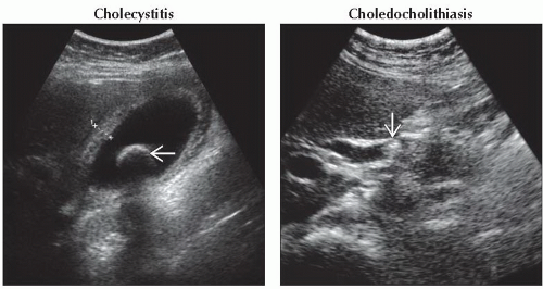 DA4-DB2-Epigastric_Pain-FFU4.gif | Abdominal Key