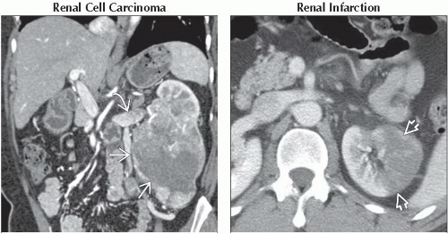 DA7-DB2-Acute_Left_Lower_Quadrant_Pain-FFU12.gif | Abdominal Key